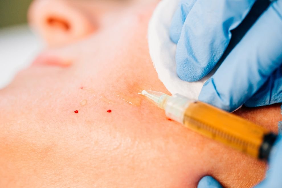 O que é uma Incubadora Plasma Gel? Qual a sua função? - SP Labor