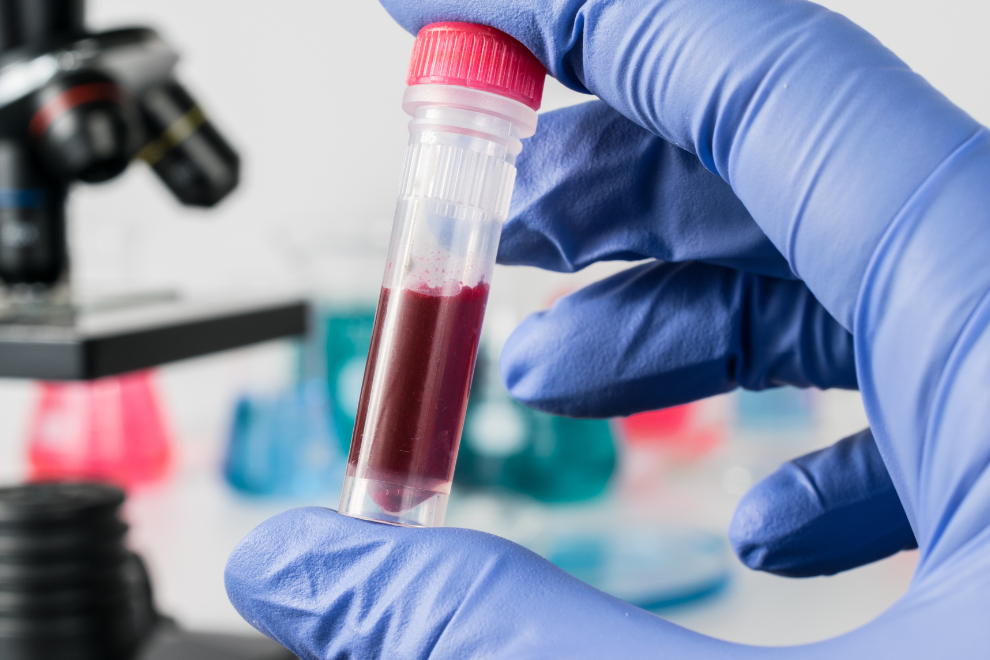 Contaminação Cruzada em Material para Laboratório - SP Labor