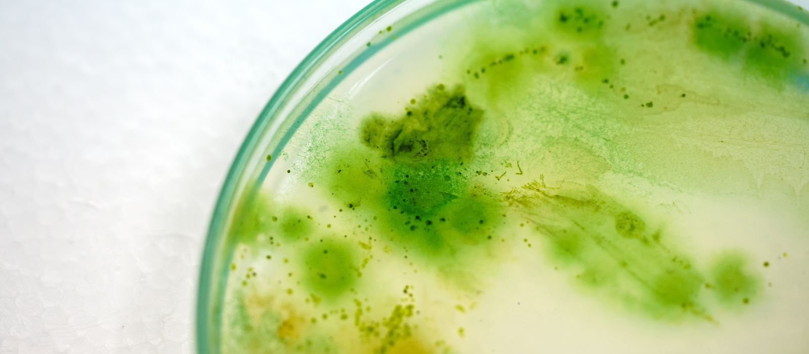 Meio Luria Bertani- Função, Composição e Princípios - SP Labor